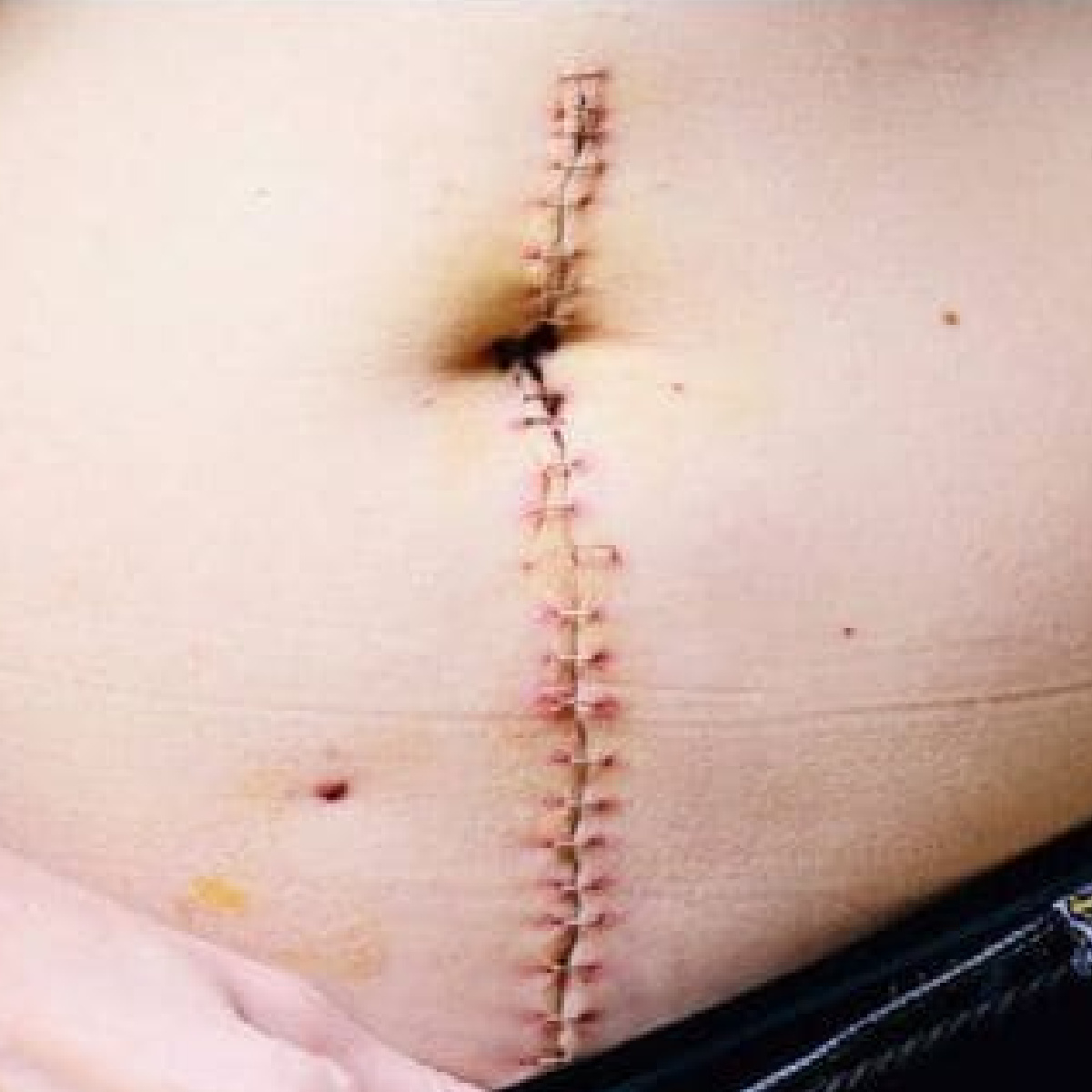 Inspirational Quotes for Surgery Day | The Inspiration Edit