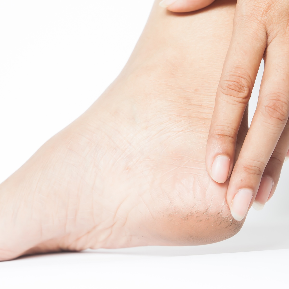 How to Recognize and Treat Common Foot Problems | The Inspiration Edit